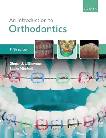An Introduction To Orthodontics Simon J Littlewood ,Laura Mitchell ...