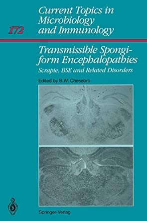 Transmissible Spongiform Encephalopathies Scrapie Bse And Related Human ...